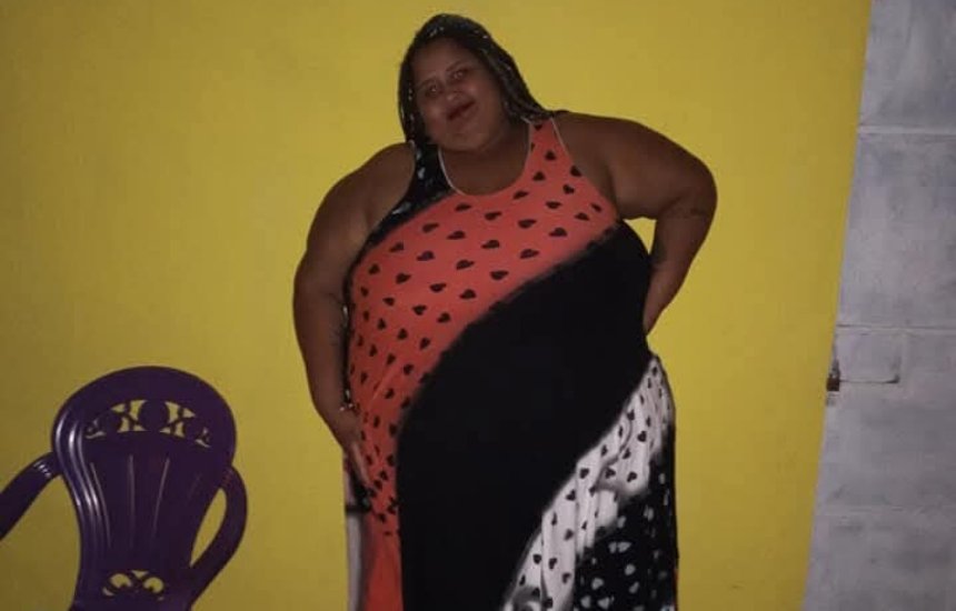 Moradora de Dias d’Ávila faz apelo para conseguir cirurgia bariátrica